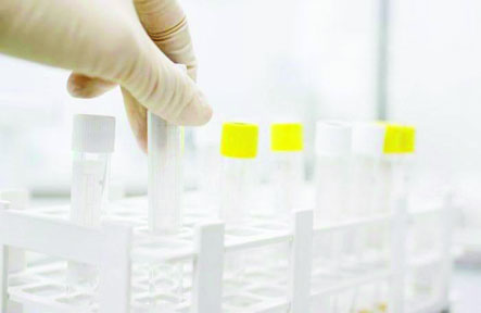 Locally-developed ASF Test Kits Now Available | Police Files! Tonite