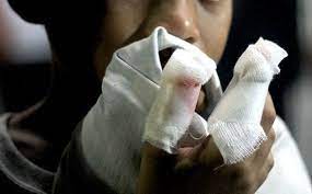 Limang araw bago ang Bagong Taon...BIKTIMA NG PAPUTOK NASA 52 NA ...